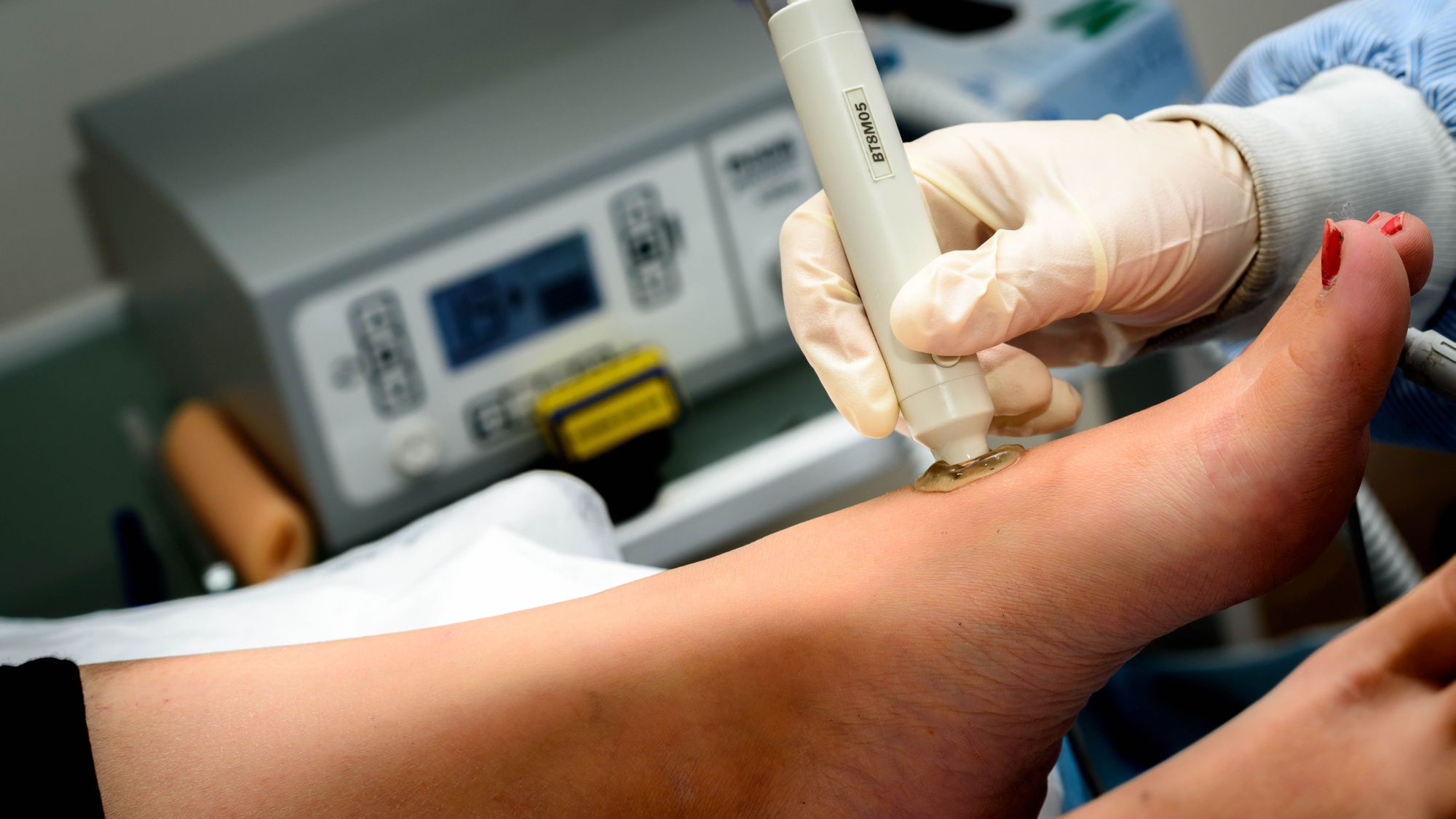 Doppler Ultrasound | The Fresh Foot Centre