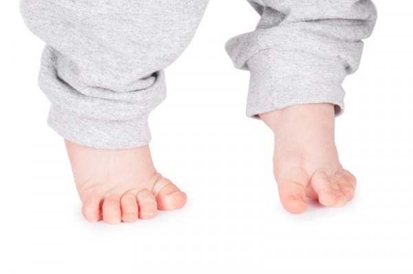 Toe Walking in Kids | The Fresh Foot Centre